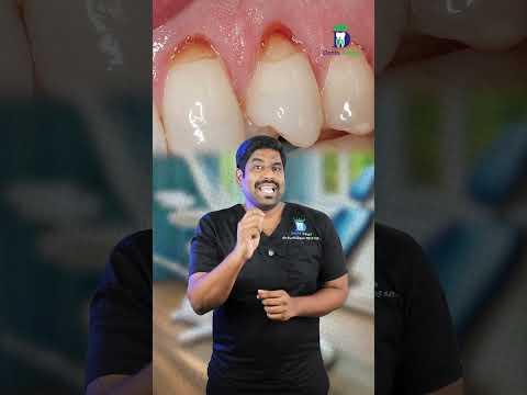 பல் சுத்தம் செய்தால் கூசுமா? Sensitivity during dental scaling | Dr.Karthikeyan | Denta Kings