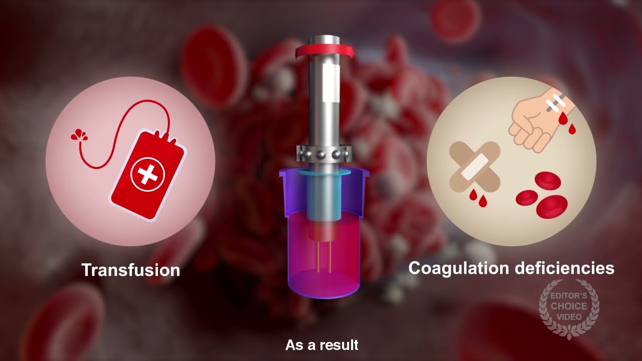 Rotational Thromboelastometry in Trauma