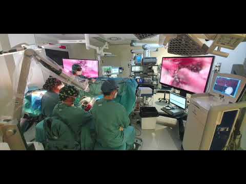 Dr. Edgar Casajuana: Olfactory Groove Meningioma - ORBEYE