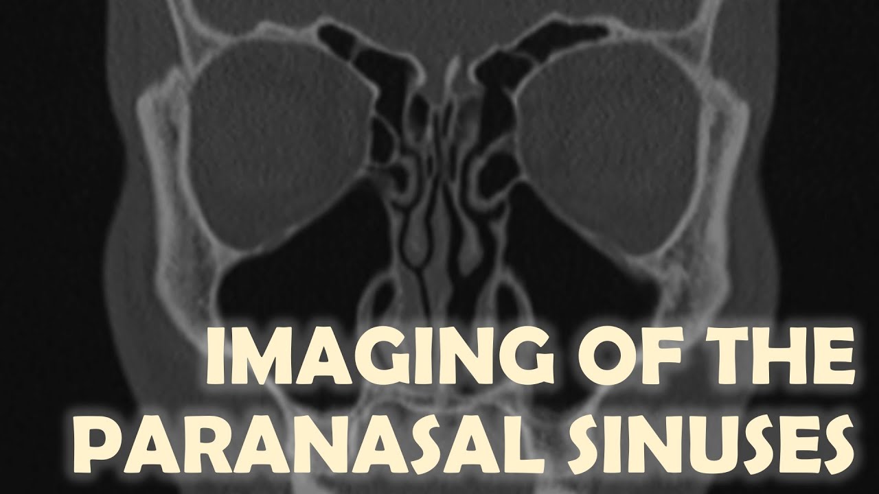 Understanding the Anatomy of the Paranasal Sinuses | Galaxy.ai