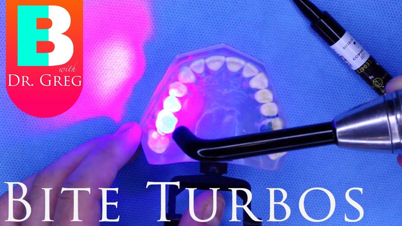 [BRACES EXPLAINED] Bite Turbos