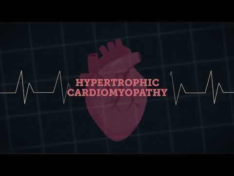 What is HCM?