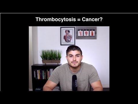 Does Thrombocytosis = Cancer?