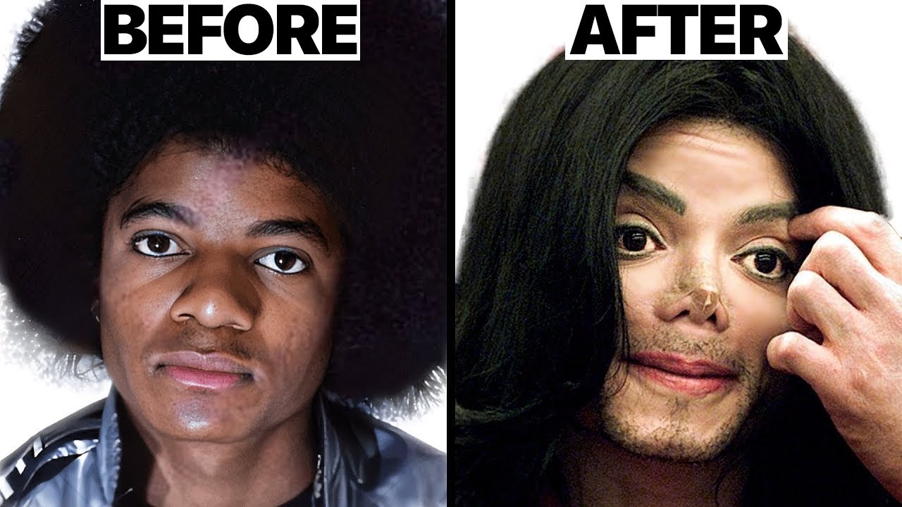 Michael Jackson Nose Job Plastic Surgeries - Surgeon Reacts