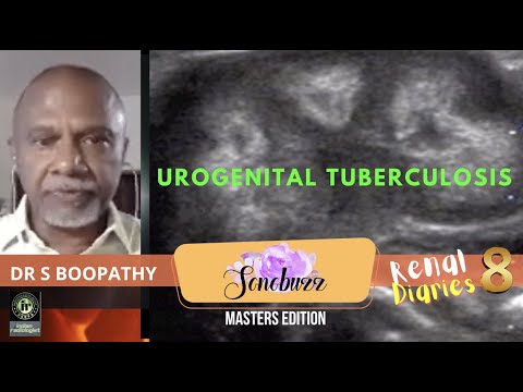 UROGENITAL TUBERCULOSIS || DR S BOOPATHY || RENAL DIARIES 8