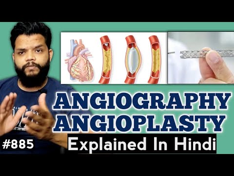 Angiography Kya Hoti Hai Kaise Hoti Hai | Angiography & Angioplasty In Hindi