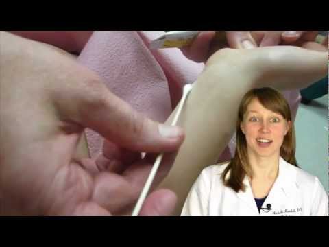 Applying Topical Numbing Cream For Molluscum
