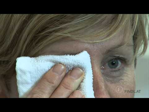 Blepharitis Prof. Findl, Vienna