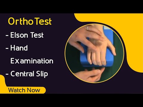OrthoTest - Elson Test | Hand Examination | Central Slip • Video ...