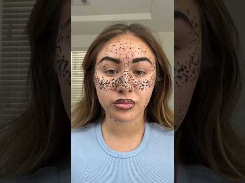 HERE WE GO AGAIN… 🙄#henna #freckles #makeuphacks