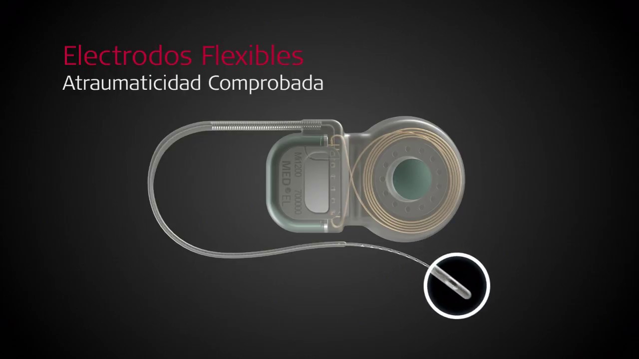 RMN e implantes cocleares