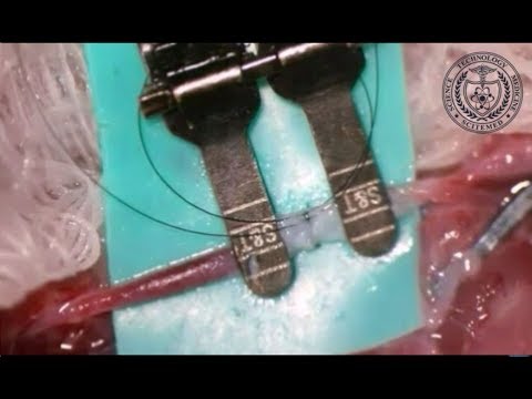 Improving Microvascular Anastomosis Efficiency by Combining Open-Loop ...