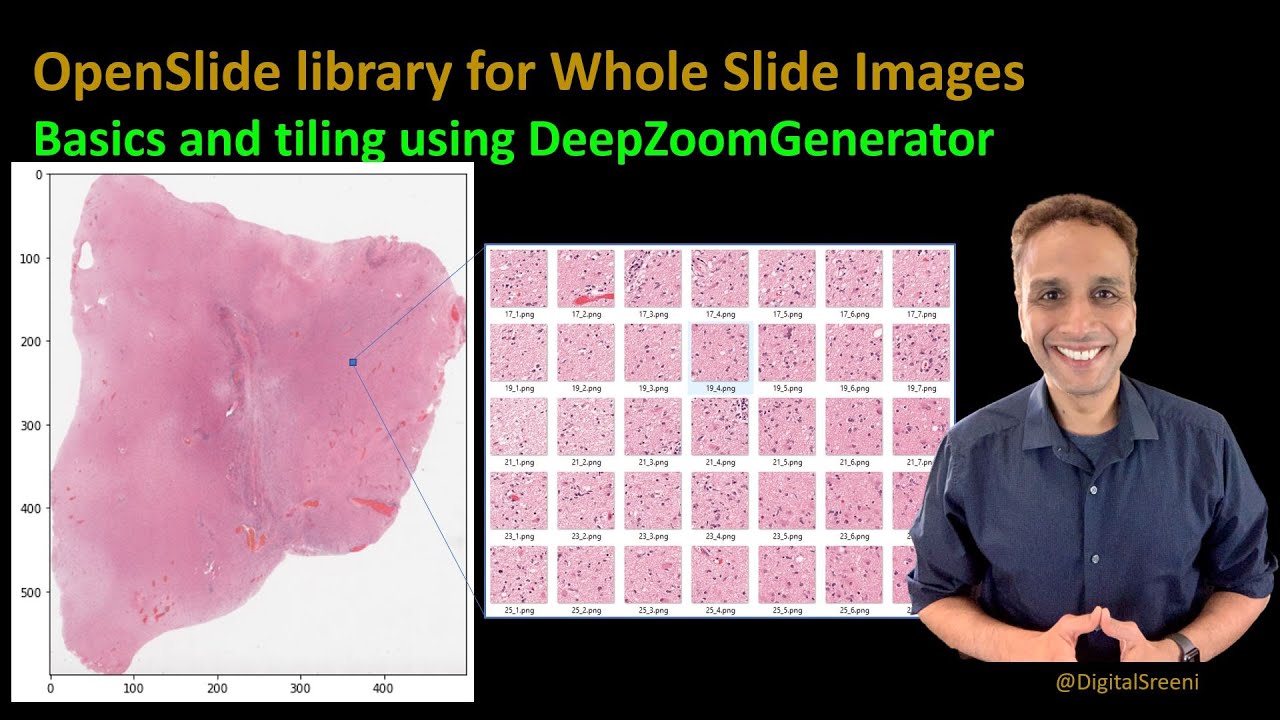 266 - Openslide library for whole slide images