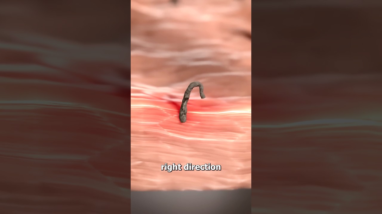 What Is An Ingrown Hair¿ 😟 Surgeon Reacts