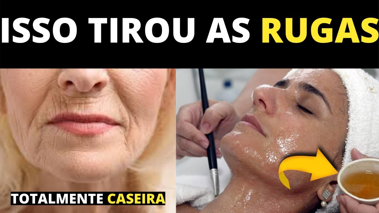 (MASCARA TIRA RUGAS RÁPIDO) Veja Como Acabar Com as Rugas e Linhas de Expressão Muito Rápido