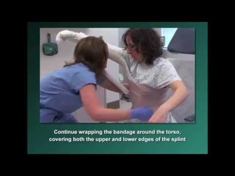 Burns 401: Axillary Splints Video Lecture - Introduction to Burn Care ...