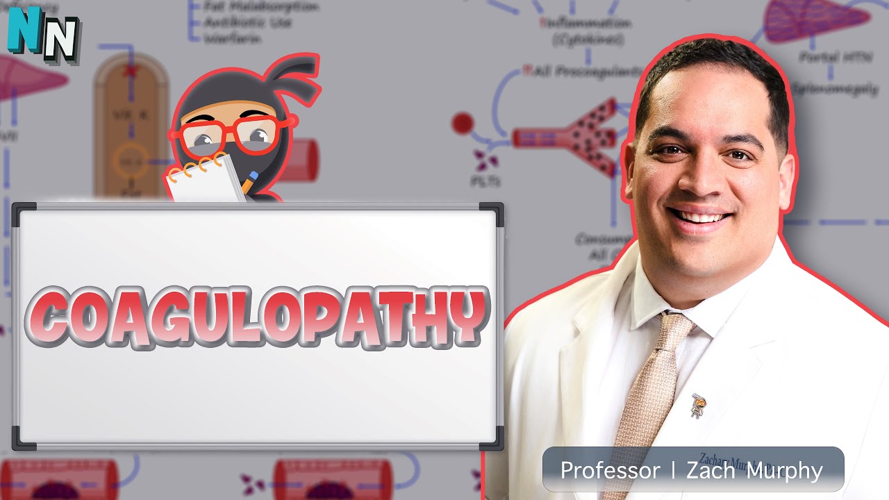 Coagulopathy | Clinical Medicine