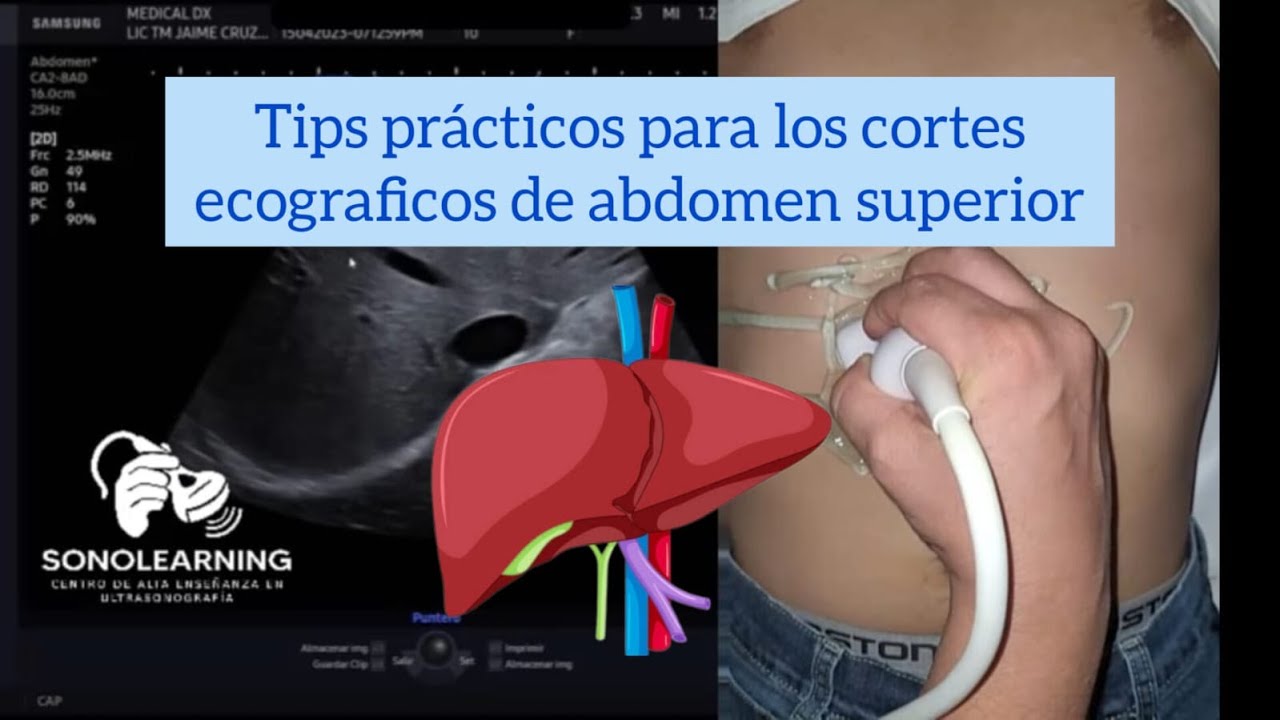 Protocolo Ecográfico Básico de Abdomen superior