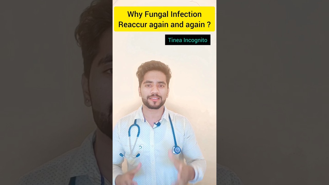 Reaccurence of fungal Infection, why it is so ? by Dr Ajith Kumar #shorts #fungalinfections #skin