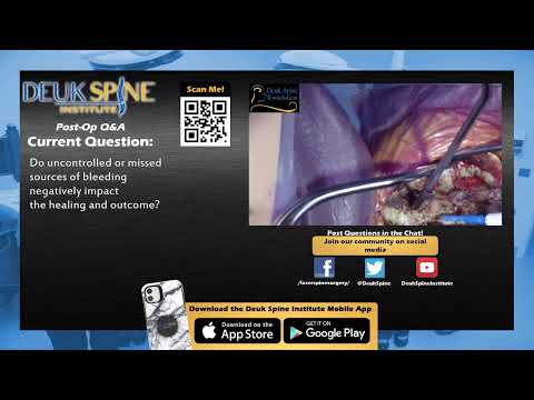 Recommended PCDF Spinal Fusion? Watch How It Is Done LIVE C2-T3