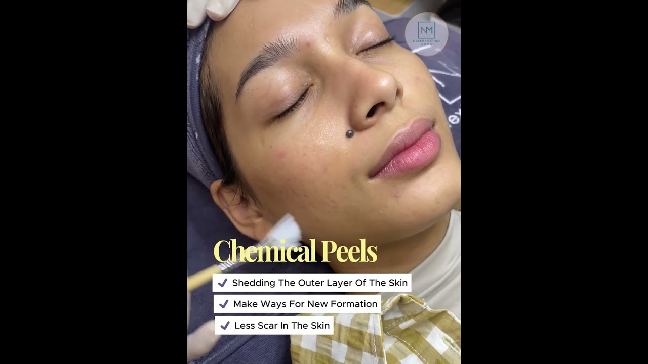 Effective Acne Scar Removal in Malaysia | Affordable Scar Removal Costs Explained
