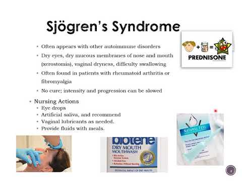 Sjögren’s Syndrome