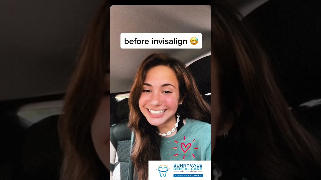 Before and After Invisalign