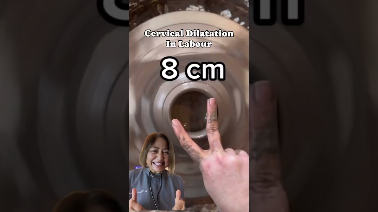 Doctor Explains full cervical Dilatation# pregnancy #labour