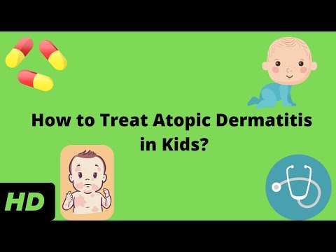 How to Treat Atopic Dermatitis in Kids?