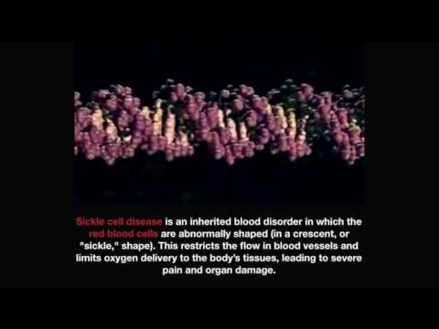 FDA approves Endari for Sickle cell disease