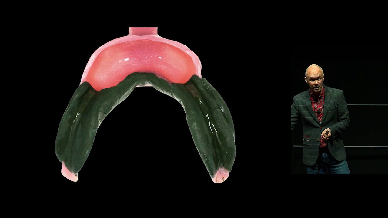 Finlay Sutton - Removable partial dentures