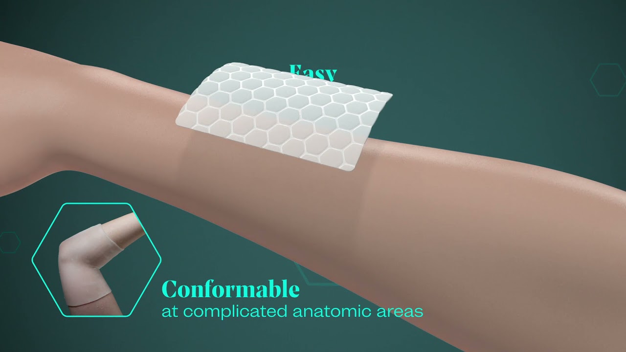 MatriDerm® - Flex Dermal Matrix
