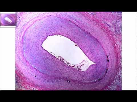 Elastic CT.mp4