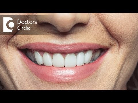 What causes gum infection under fixed bridge & how to manage it? - Dr. Arundati Krishnaraj