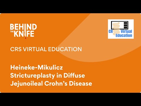CRS Virtual Education: Heineke-Mikulicz Strictureplasty in Diffuse Jejunoileal Crohn’s Disease