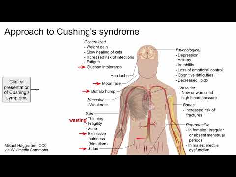 Approach to Cushing's syndrome