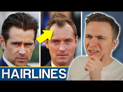 Widows Peak VS Receding Hairline - Should You Be Worried?