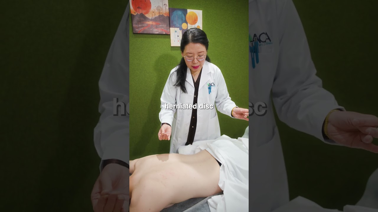 Sciatica Pain Treatment  #backpainrelief #chronicpain