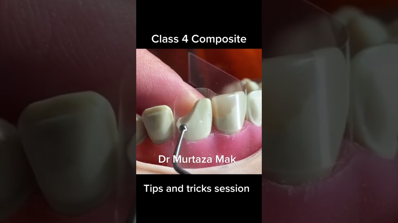 Class 4 Composite tips and tricks session