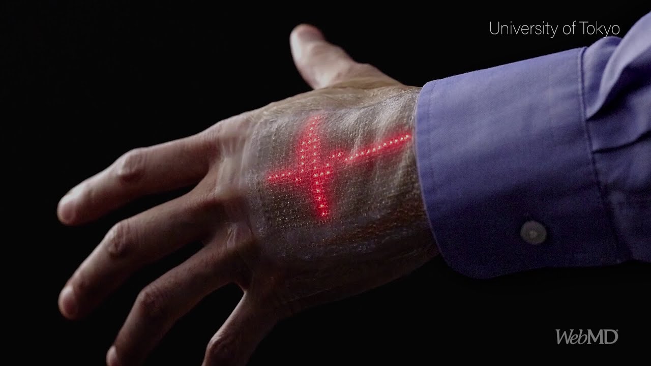 Skin Electronics | WebMD