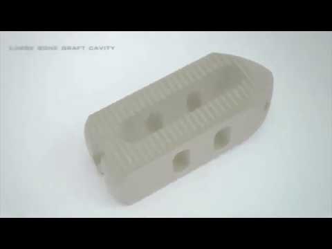 SAFE ORTHOPAEDICS: Cedar Elm Peek lumbar cages
