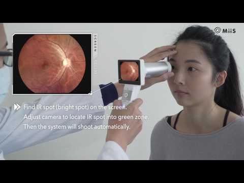 Fundus Camera - Retinal Camera Latest Price, Manufacturers & Suppliers