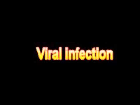 What Is The Definition Of Viral infection