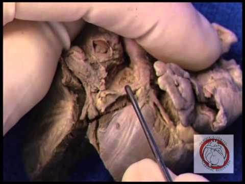 Coronary Arteries