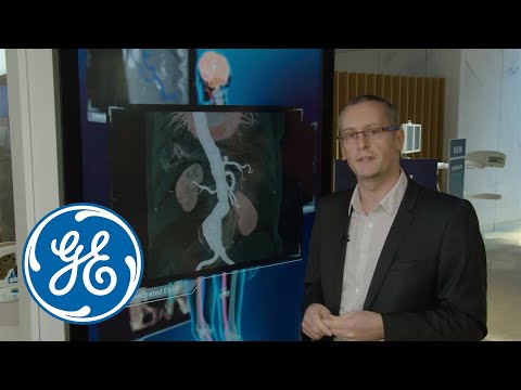 What's new with GE Healthcare - Discovery IGS 7 OR