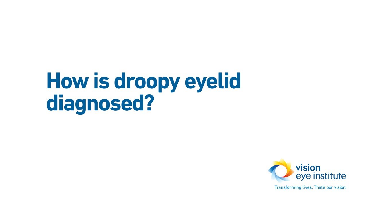 How is a droopy eyelid diagnosed?