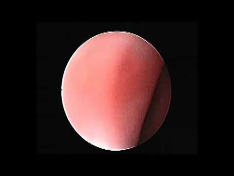 diagnostic nasal endoscopy