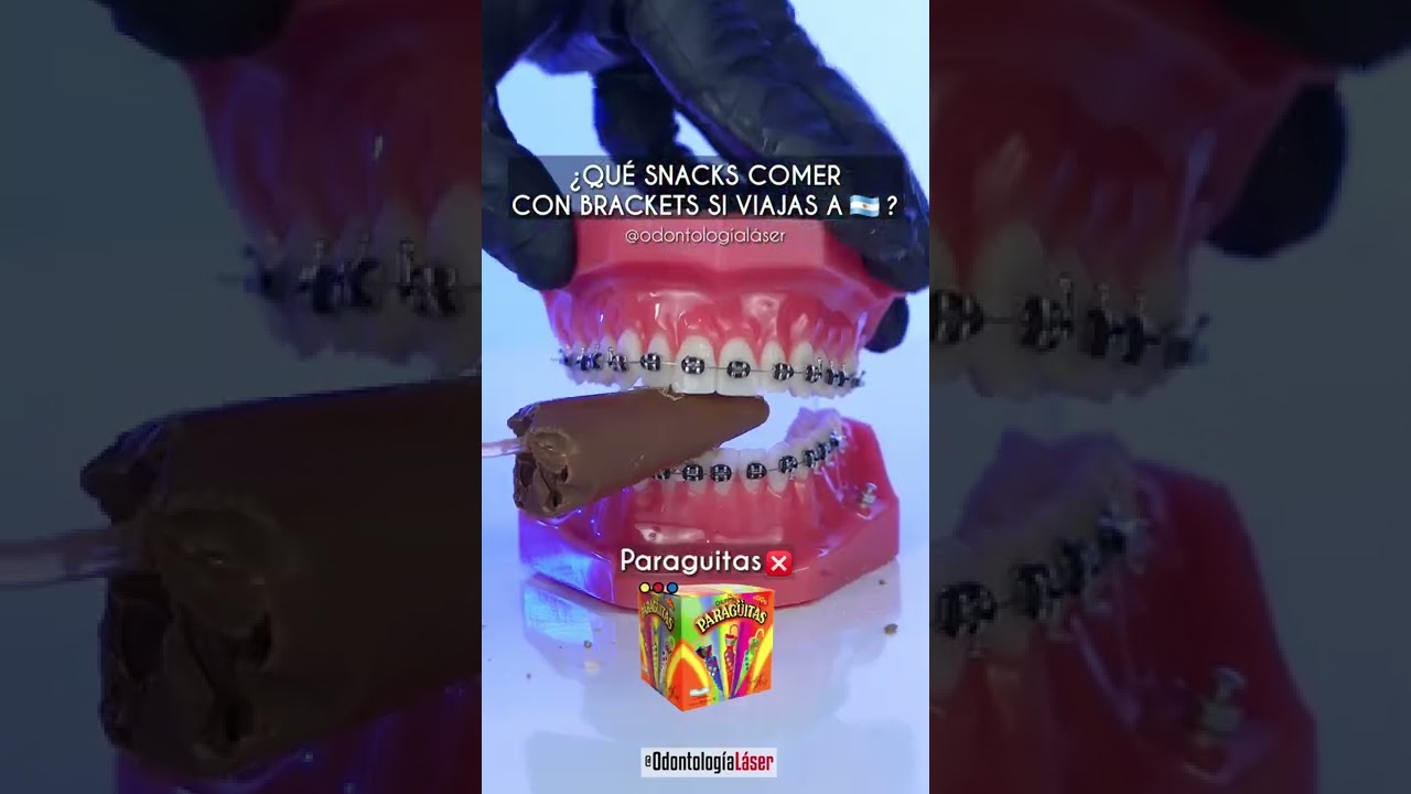 ¿Qué alimentos comer con brackets si viajas a 🇦🇷? - Odontología Láser #Shorts
