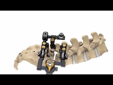 Modulus TLIF O - Product Animation