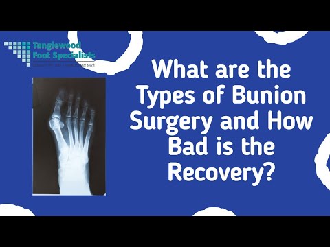 What are the Types of Bunion Surgery and How Bad is the Recovery?